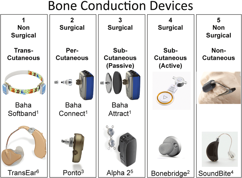 What Is Unilateral Hearing Loss aka Single Sided Deafness